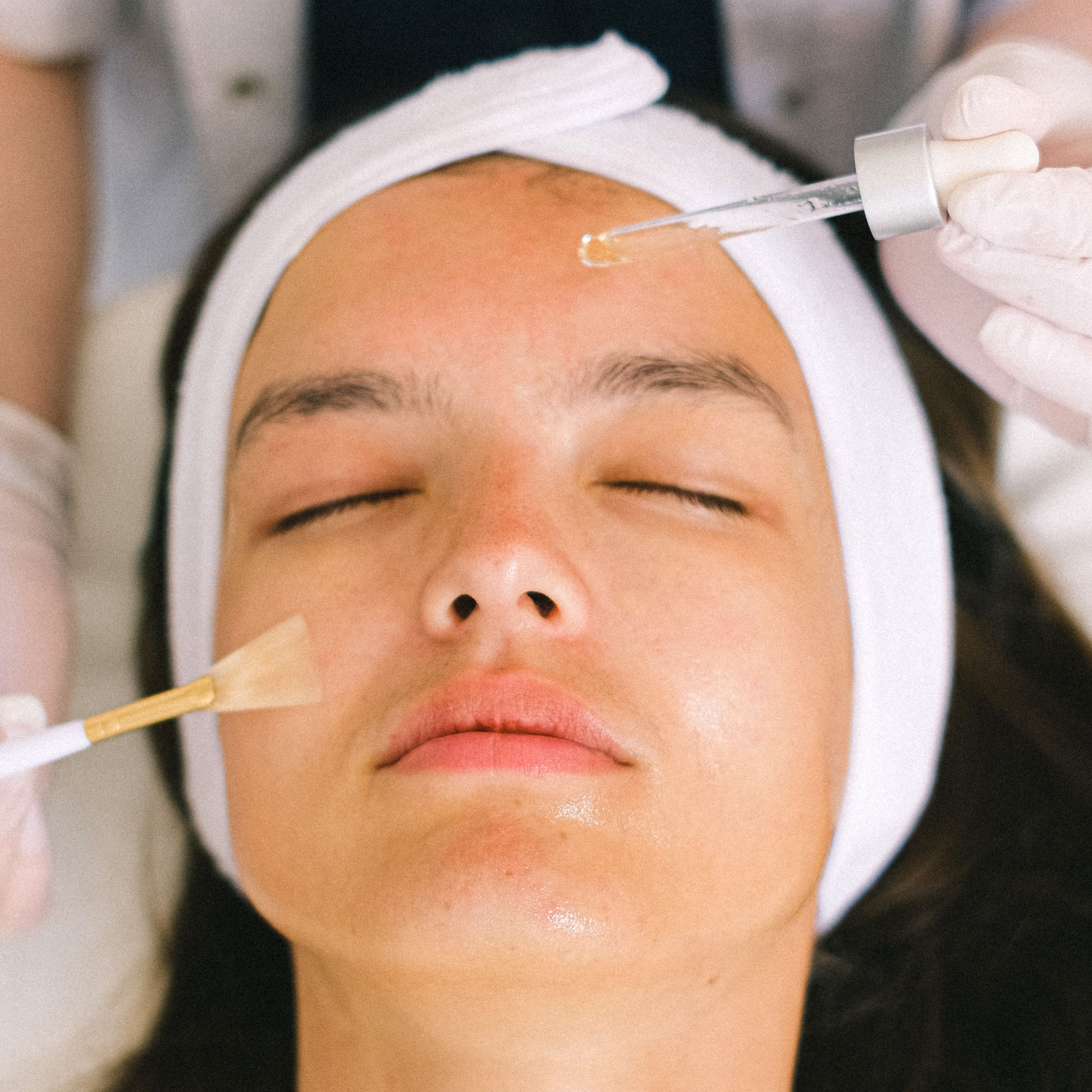 Chemický peeling pro obnovu zdraví buněk